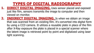 Dental digital radiography | PPTX