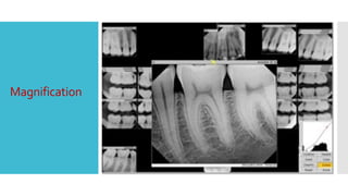 Dental digital radiography | PPTX
