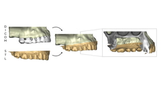Dental Digital Scanners: Intraoral and Extraoral 3D Scanners | PDF