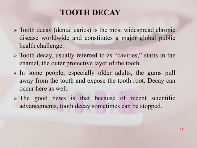 Dental diseases | PPTX | Oral care | Personal Care
