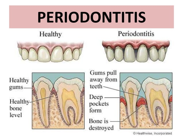 Dental disorders | PPTX | Dental Health | Diseases and Conditions