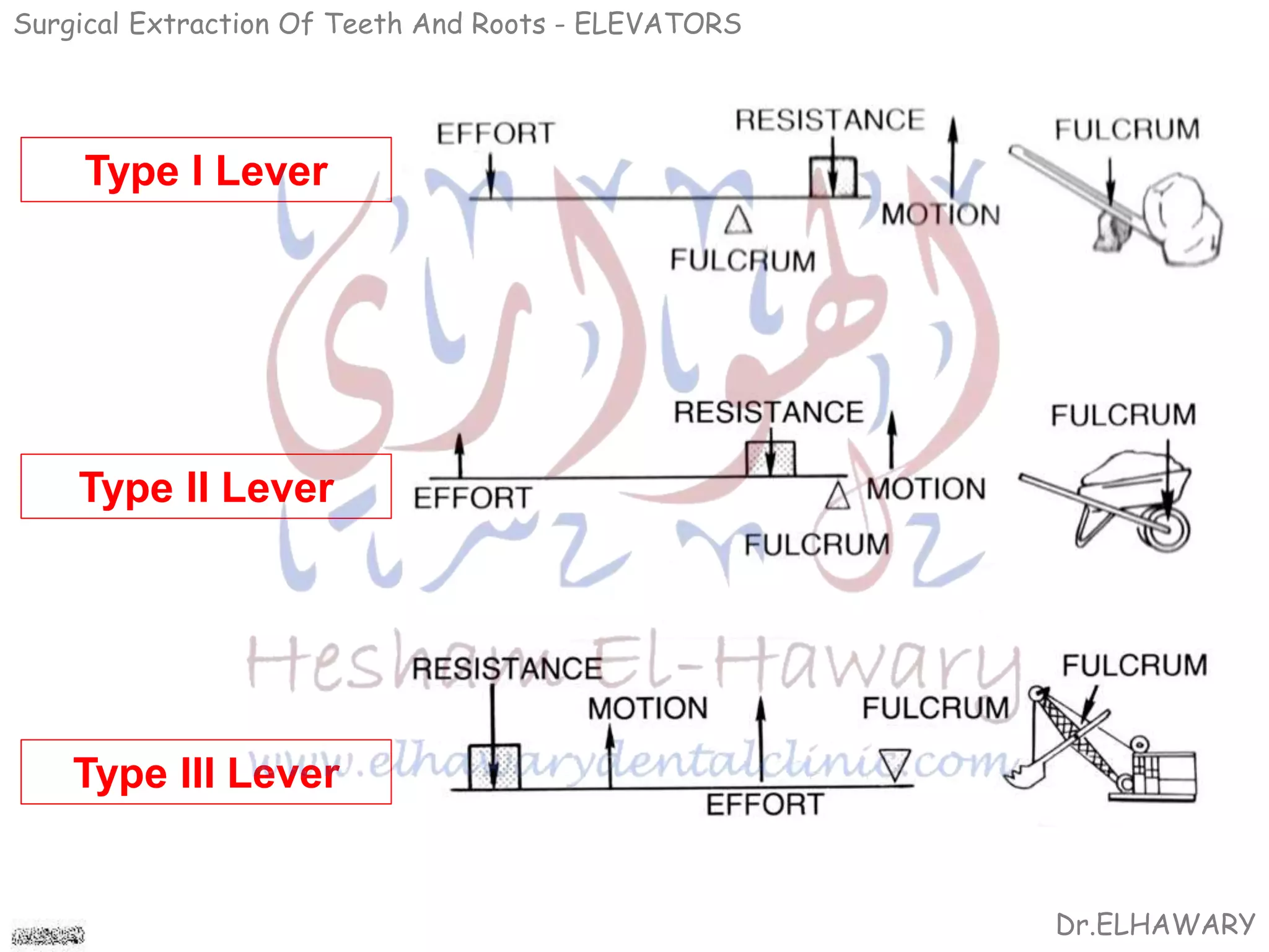 Dental elevators | PPTX