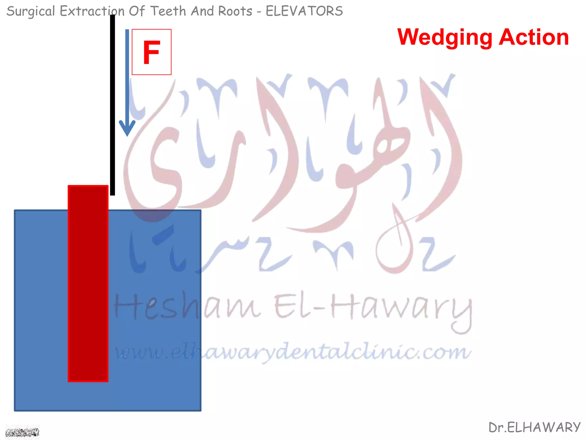 Dental elevators | PPTX