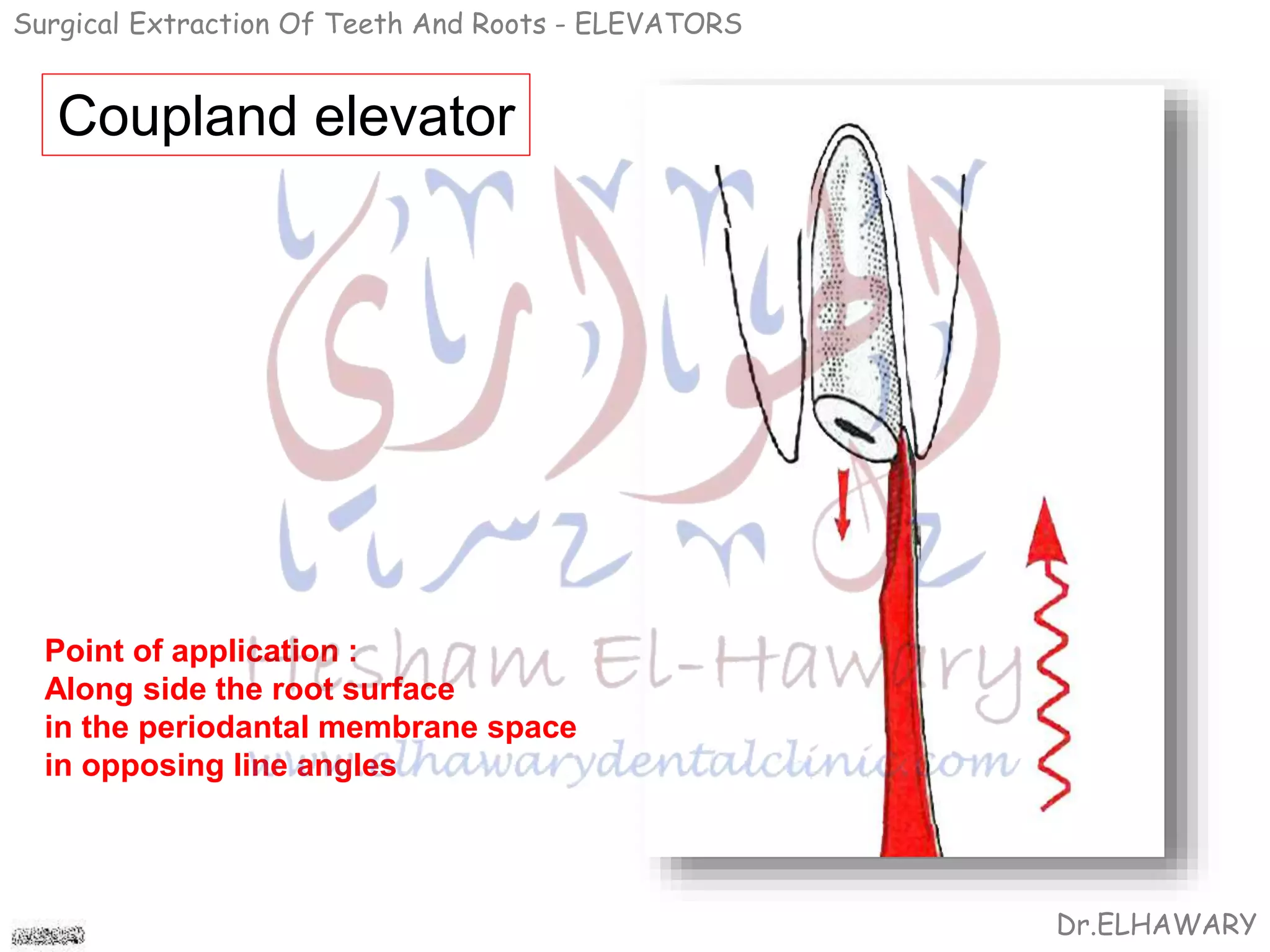 Dental elevators | PPTX
