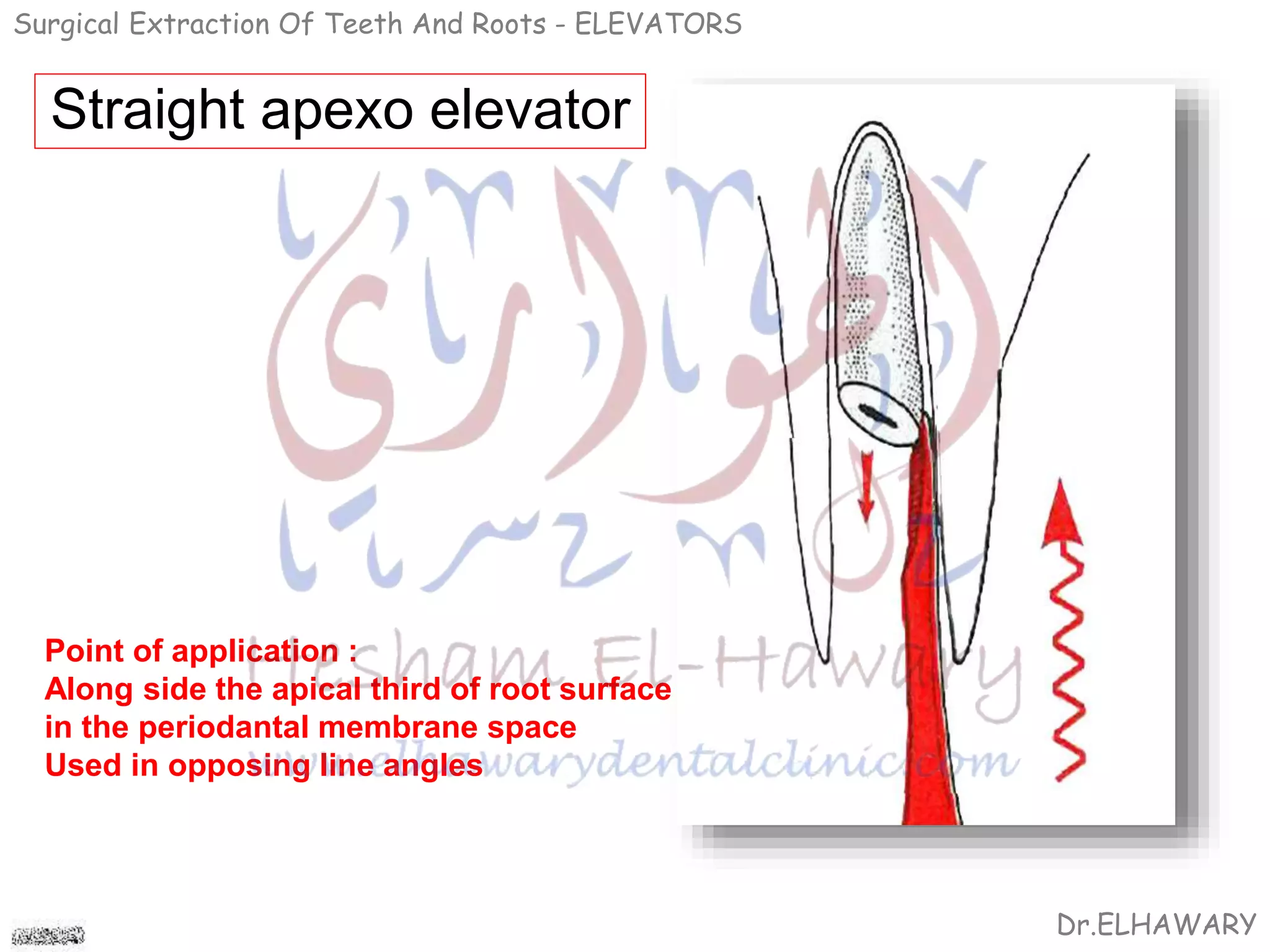 Dental elevators | PPTX