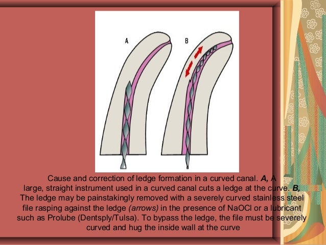 ENDODONTIC EMERGENCIES