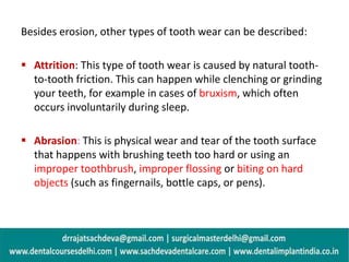 All about Dental Erosion | causes and prevention about dental erosion ...