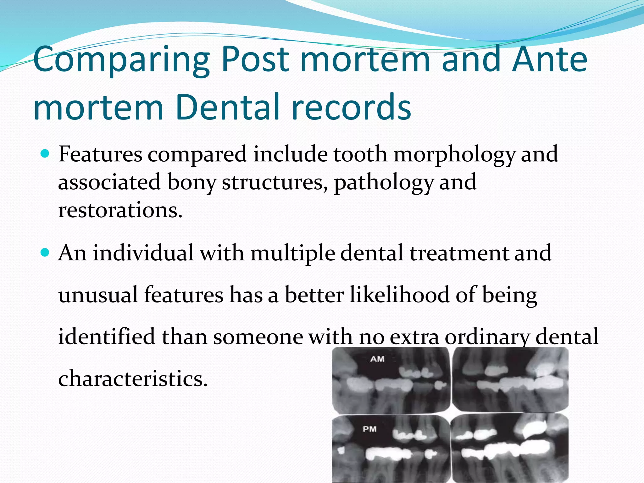 DENTAL EVIDENCES IN CRIME SCENES AND THE PROCEDURES .pptx......pptx