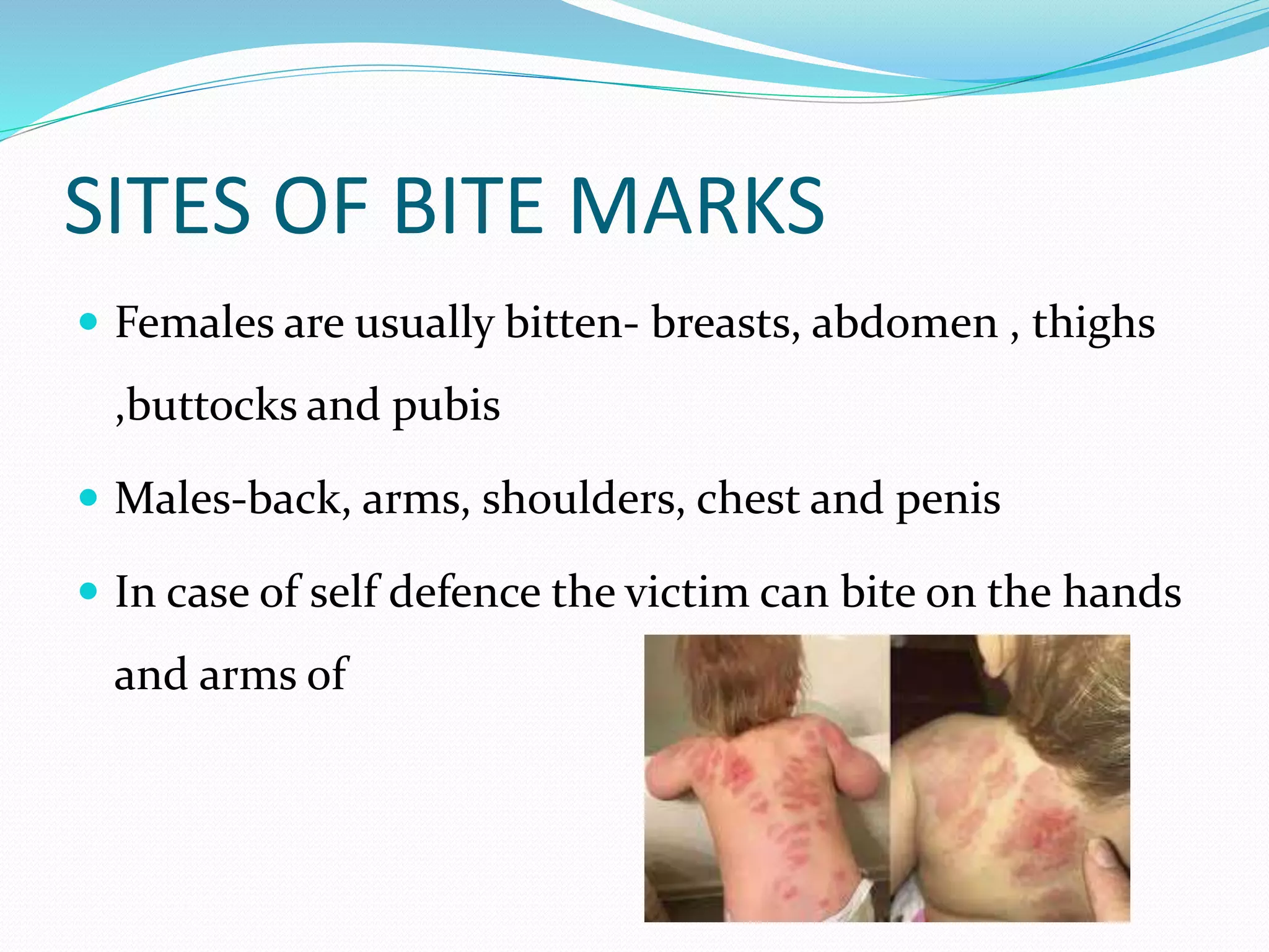 DENTAL EVIDENCES IN CRIME SCENES AND THE PROCEDURES .pptx......pptx