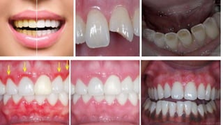 dental examination.pptx