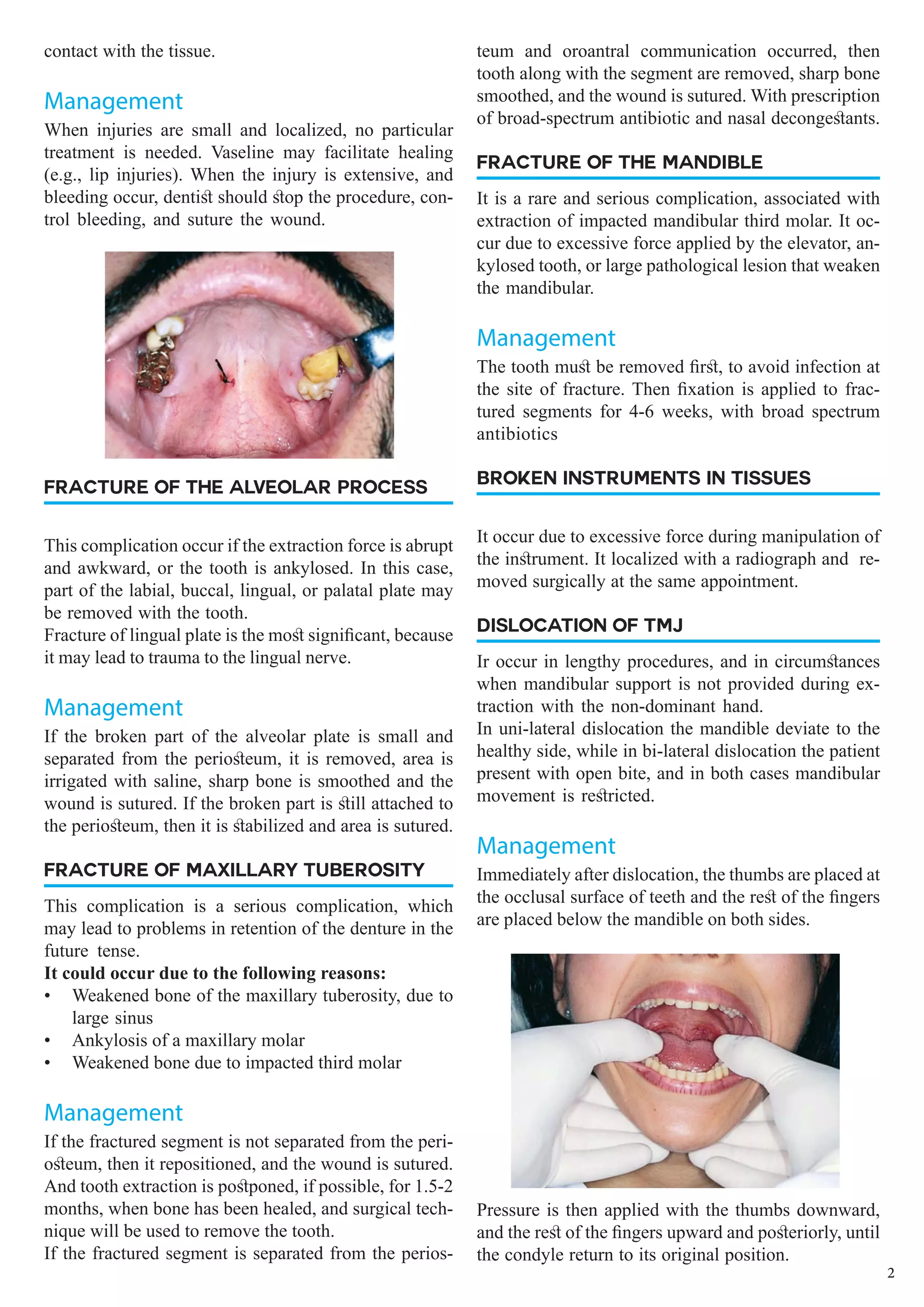 Complications occur During Dental Extraction and their Management | PDF