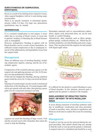 Complications occur During Dental Extraction and their Management | PDF