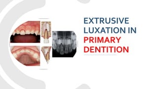 Dental Extrusion.pptx