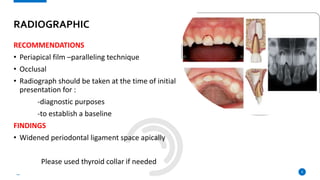 Dental Extrusion.pptx