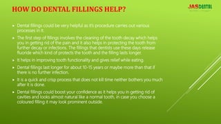 Dental fillings | PPTX