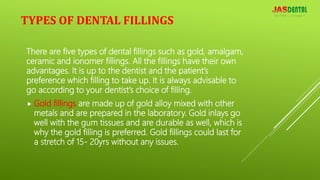 Dental fillings | PPTX