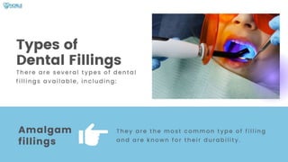 Dental Fillings.pptx | Dental Health | Diseases and Conditions