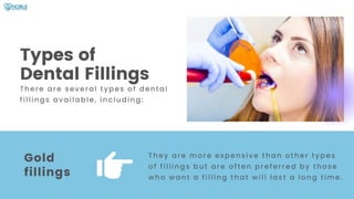 Dental Fillings.pptx | Dental Health | Diseases and Conditions