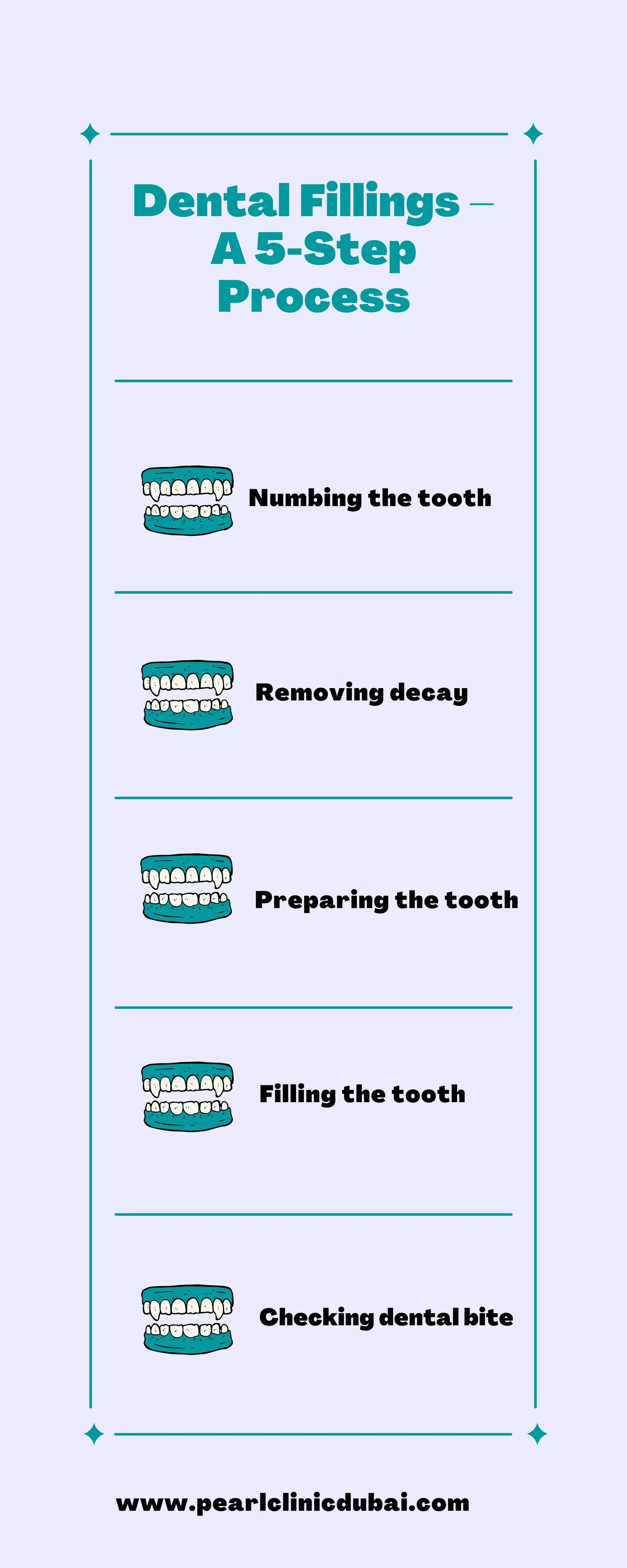 Dental Fillings – A 5-Step Process.pdf