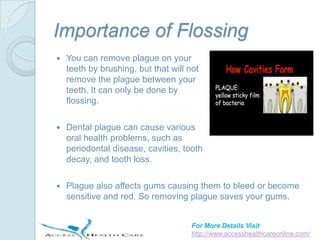 Dental Flossing | PPTX