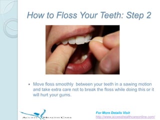 Dental Flossing | PPTX