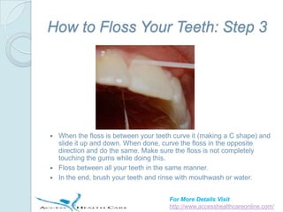 Dental Flossing | PPTX