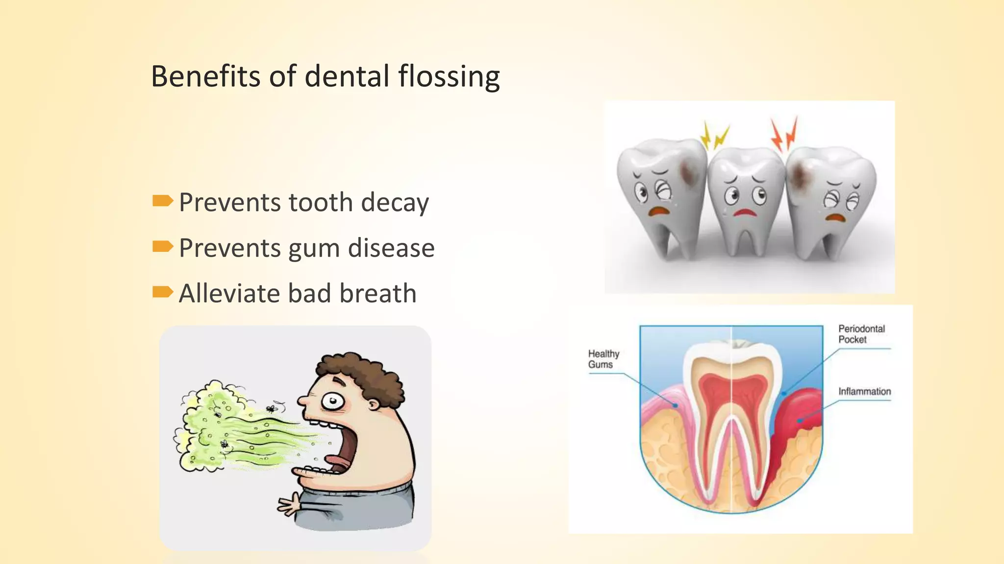 Dental flossing | PPTX
