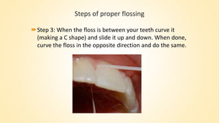 Dental flossing | PPTX