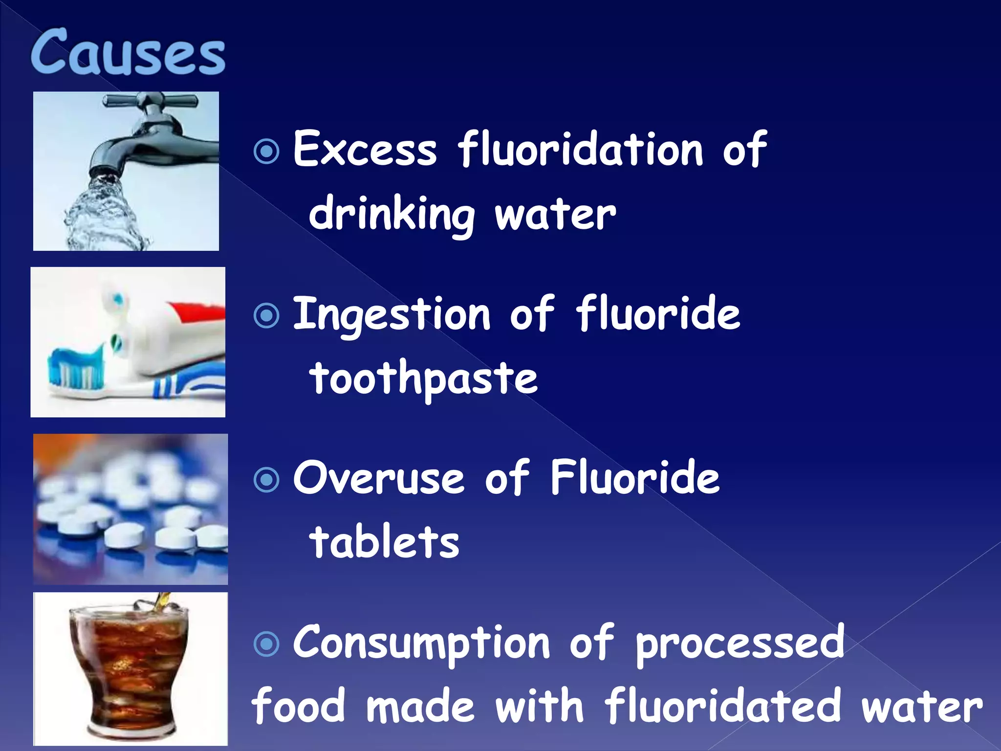 Overview on Dental fluorosis | PPTX