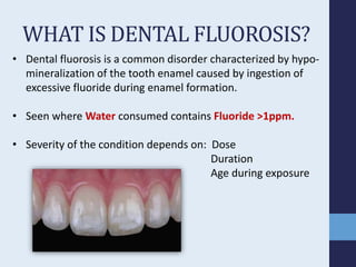 Dental fluorosis. | PPTX