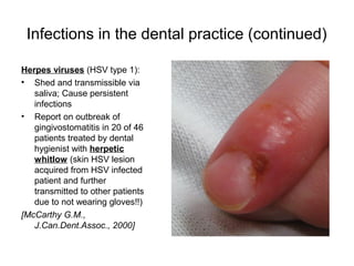 Dental healthcare associated infections an overview of pathogens, risks ...