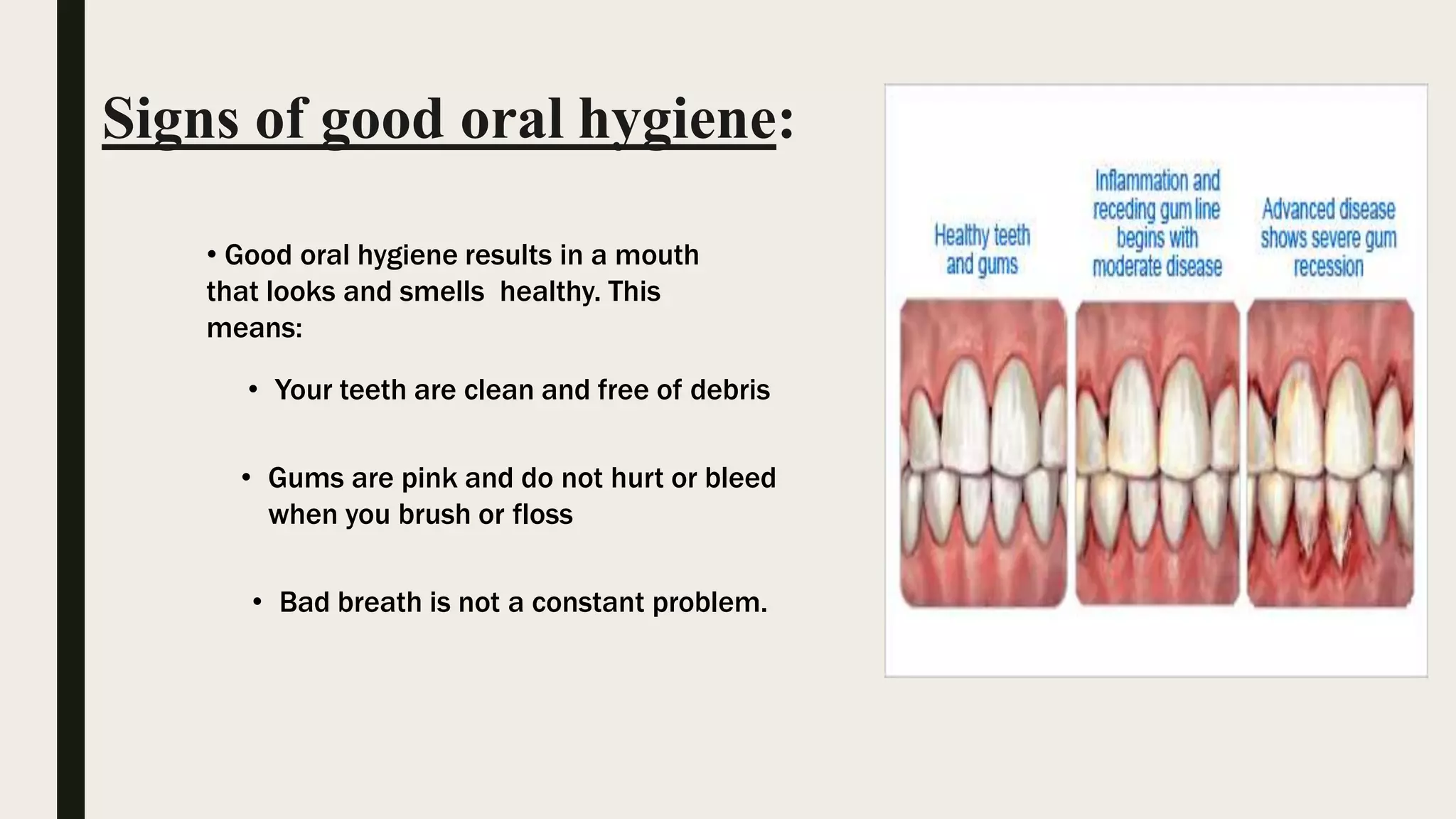 Dental health education | PPTX