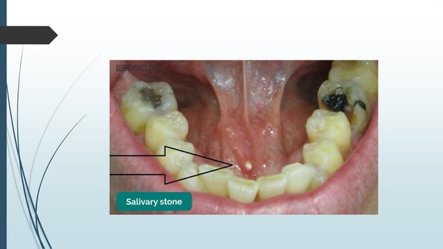 Dental hygiene and mouth cavity care. Basic examination of teeth ...
