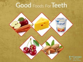 The Dental Diet - What Foods are Good or Bad for Dental Hygiene | PPTX