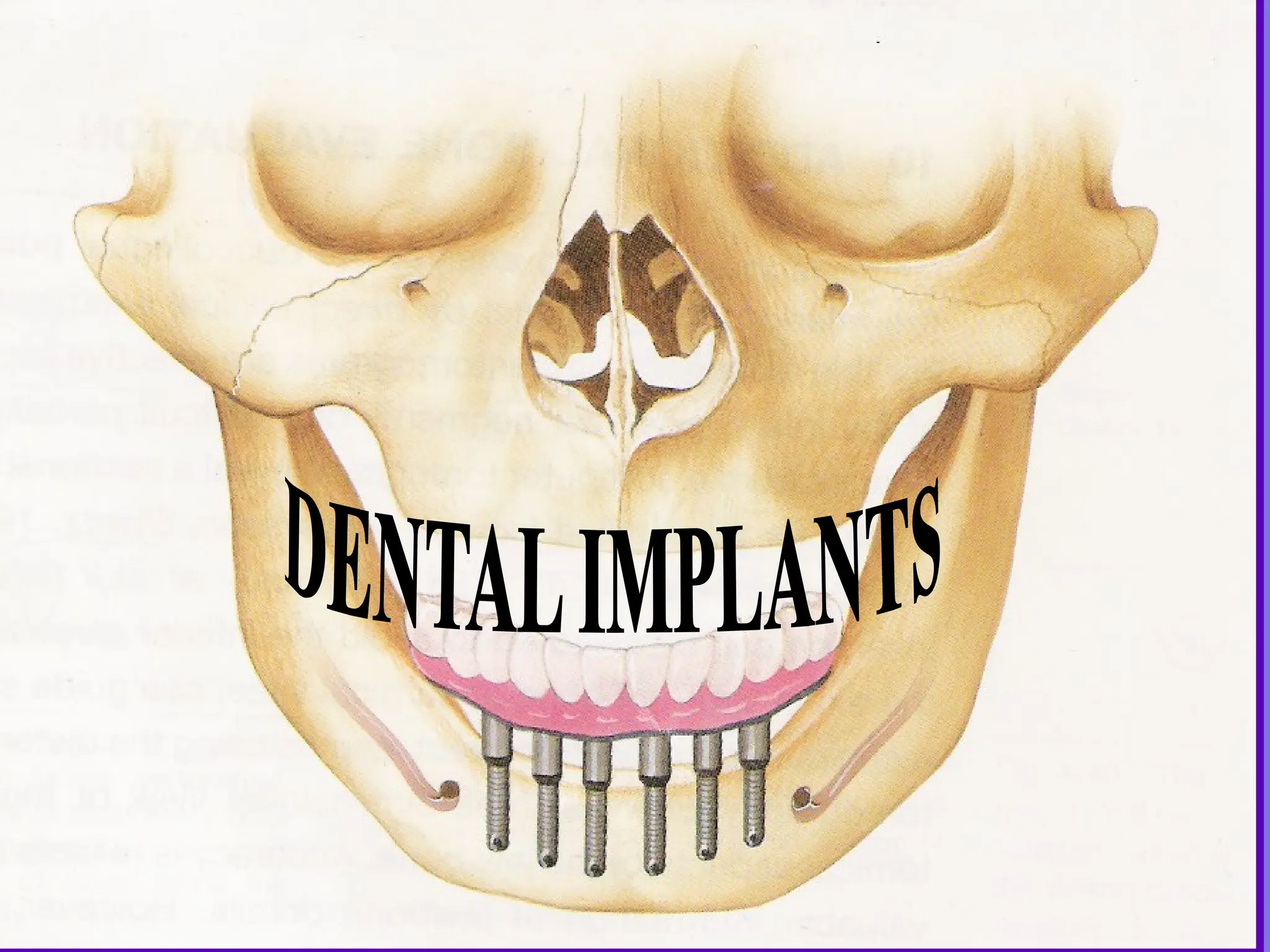 Dental_I mplan.ppt