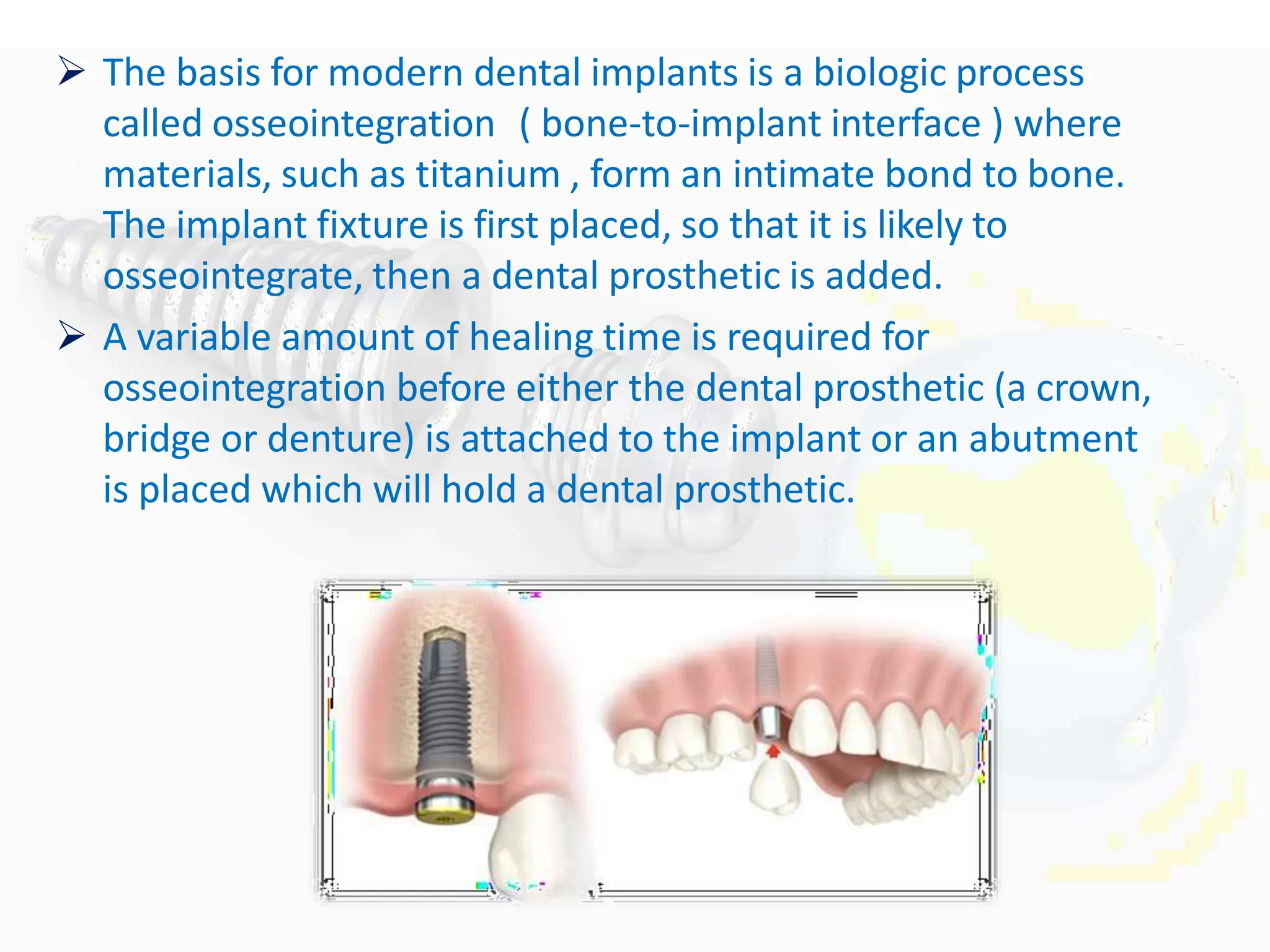dentalimplant-160204161826.pptx | Dental Health | Diseases and Conditions
