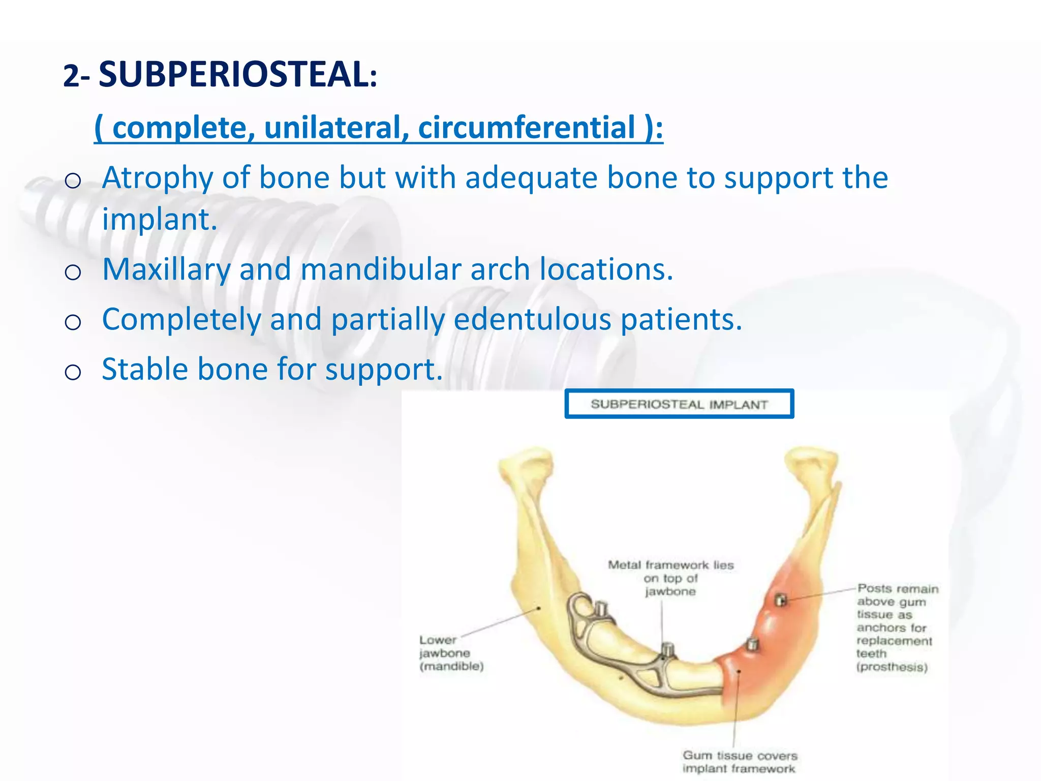 Dental implant | PPTX