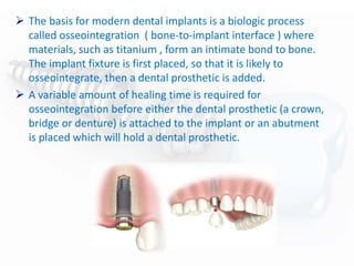 Dental implant | PPTX