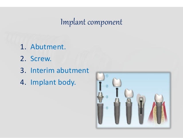 Dental implant