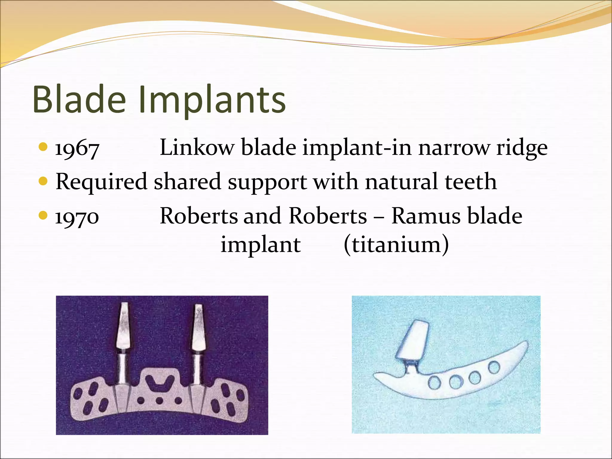 Dental Implant.ppt