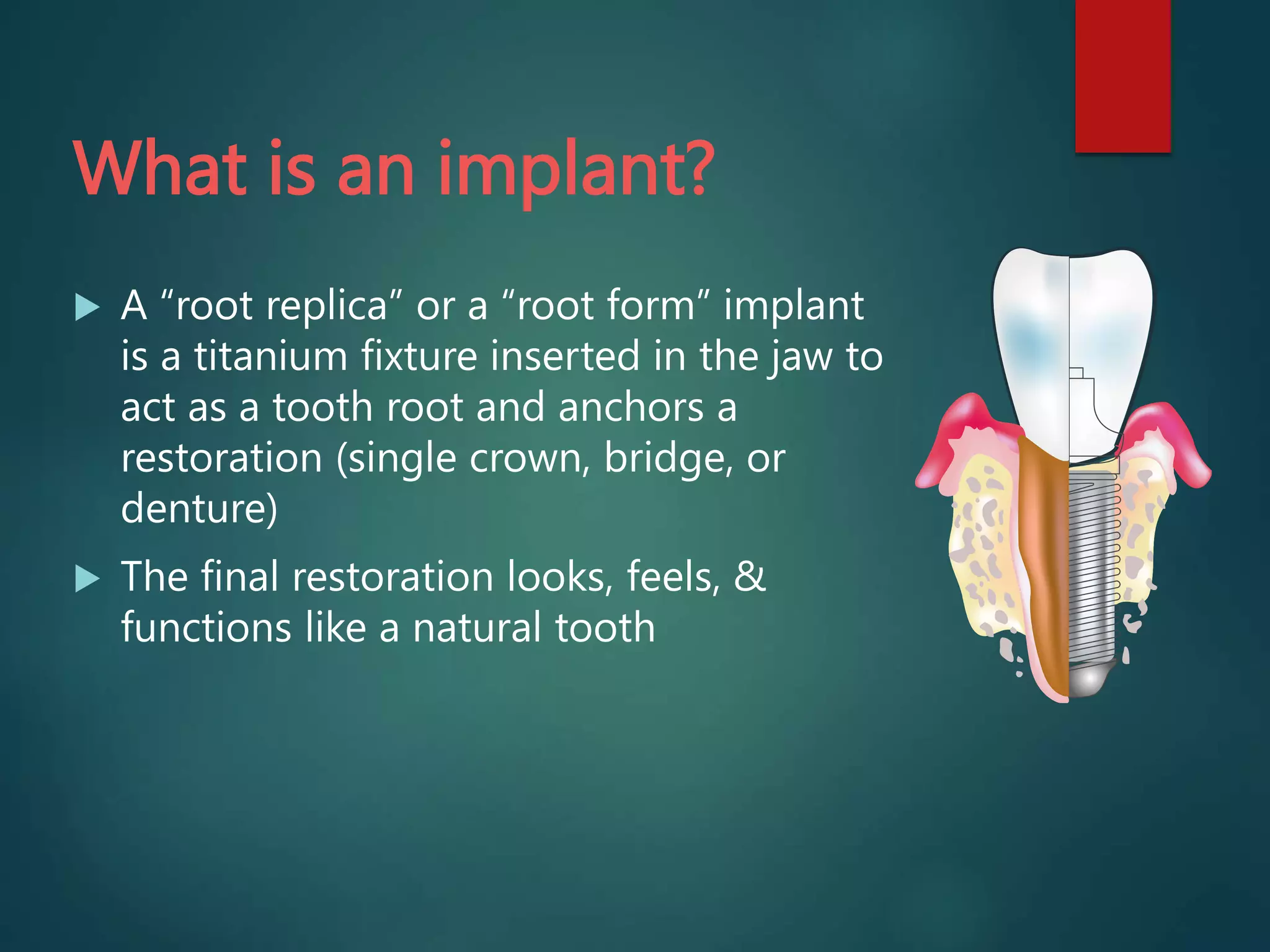 Dental implant.ppt