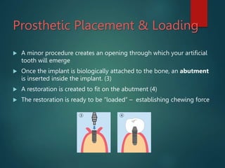 Dental implant.ppt