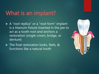 Dental implant.ppt