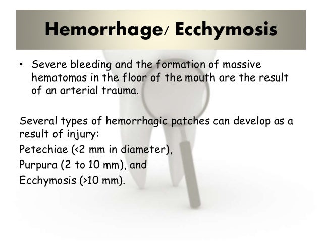 Ecchymosis Vs Bruise