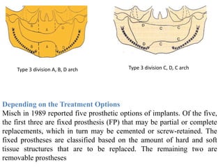 Dental Implant_1641326190.pptx