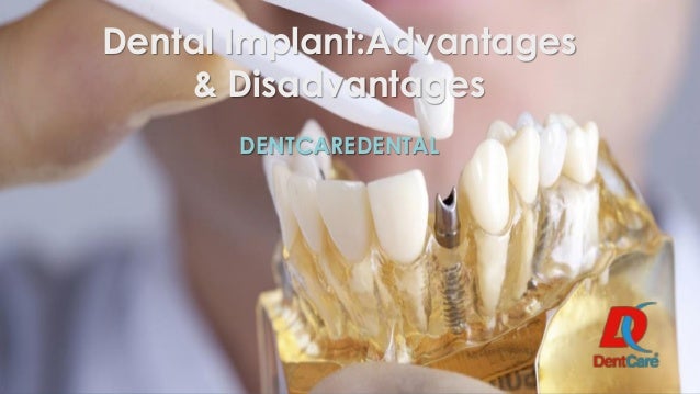 Dental Implant Advantages and Disadvantages.pdf Dental Implant Advantages and Disadvantages.pdf
