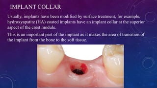 Dental implant components .pptx
