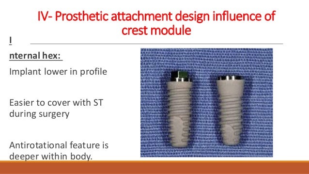 Dental implant deisgn