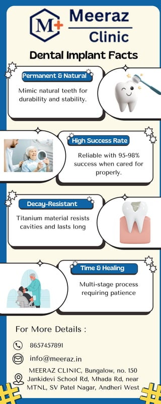 Dental Implant Facts-one should know.pdf