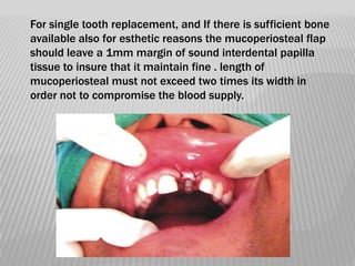 Dental implant in esthetic zone | PPTX